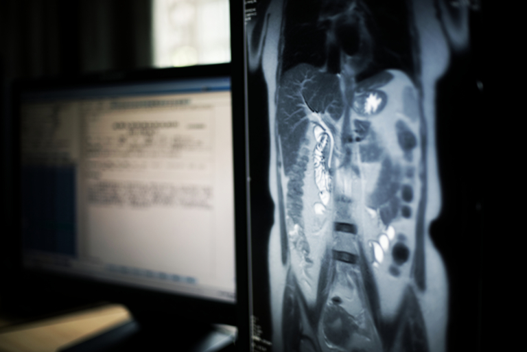 Why Vision for Remote Diagnostic Radiology Services – Vision Radiology